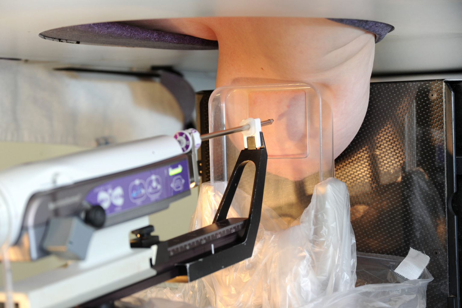 MIBB – Minimally Invasive Breast Biopsies Working Group More than 3400 ...